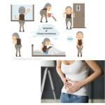 How To Manage Overactive Bladder Syndrome
