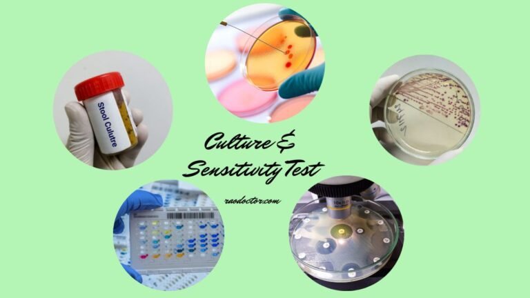 Culture And Sensitivity Test | Dr. K. P. V. Rao's Health Blogs