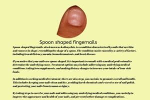 The Surprising Link Between Fingernails And Your Overall Health