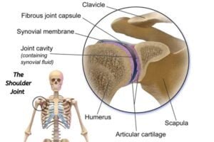 Frozen Shoulder: Causes, Symptoms, And Treatment Options